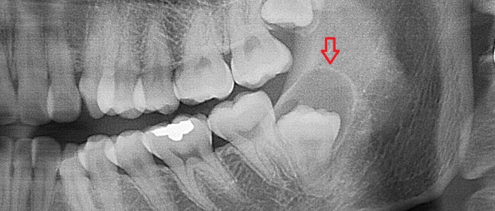 Dental Clinic Johor Bahru :: Specialized Dental Treatments | Dentist ...